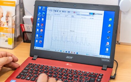 Príprava na vyšetrenie ciev Arteriografom SEO článok